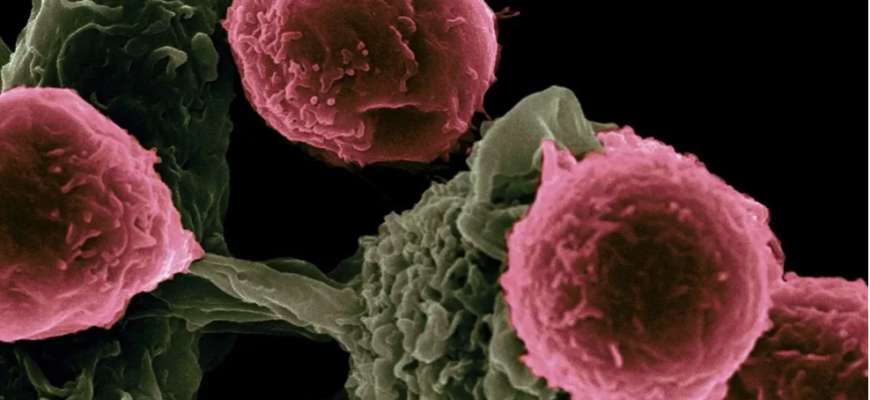 Un bărbat a murit din cauza ciumei bubonice. Tot ce trebuie să știi ...